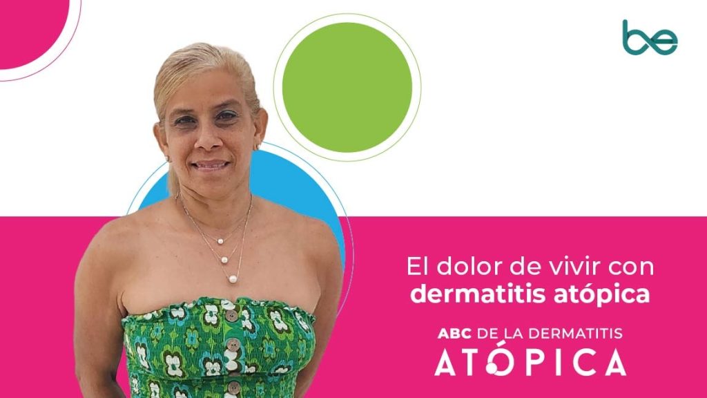 Margarita con dermatitis atópica: “Es un dolor físico que no se puede ...