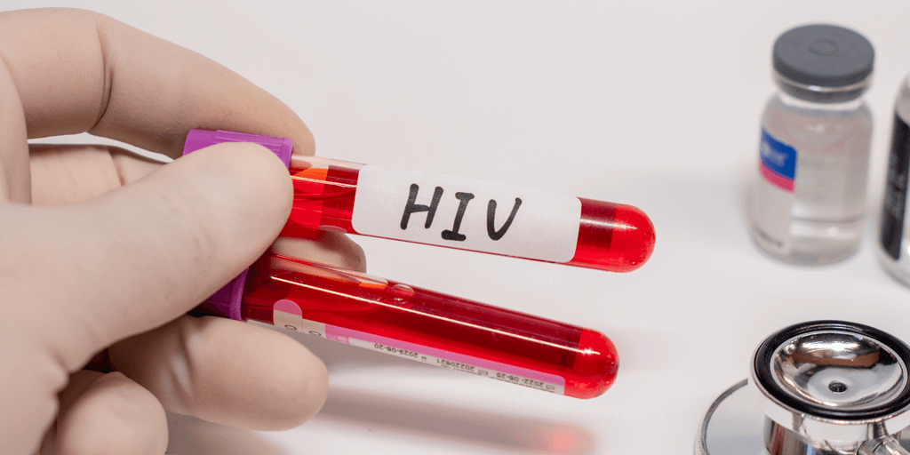 Reflexiones sobre la terminología del SIDA: ¿Por qué cambiarla? - BeHealth