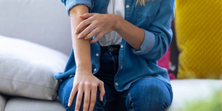 Cinco claves para comprender el prurigo nodular