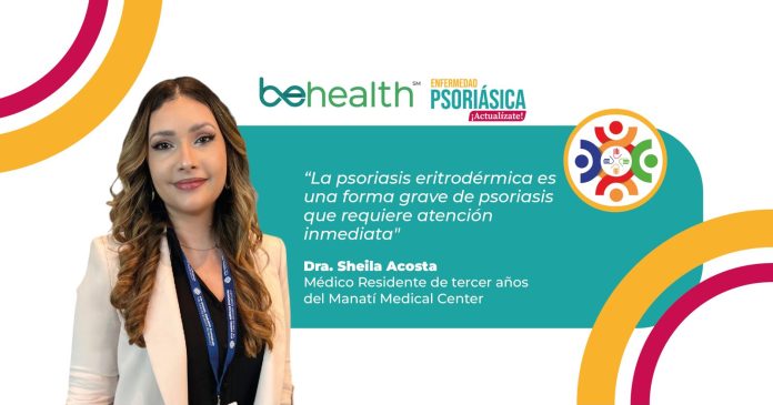 Observación médica salva a joven con psoriasis eritródermica