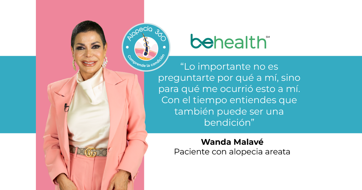 Wanda Malavé: cuando la alopecia se convierte en aceptación